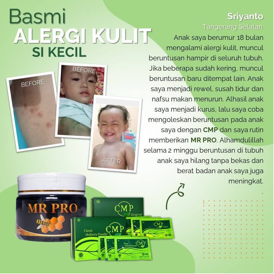 Mr Pro - Produk HWI Untuk Menambah Nafsu Makan & Daya Tahan Tubuh