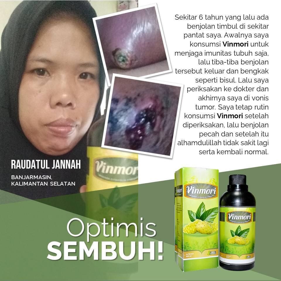 Vinmori- Produk Resmi HWI Minuman Kesehatan Ekstrak Mengkudu